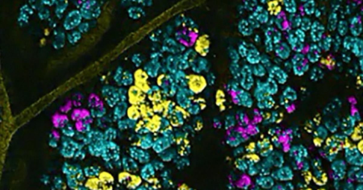 New Technique Visually Depicts How Cancer Cells Grow and Spread in ...